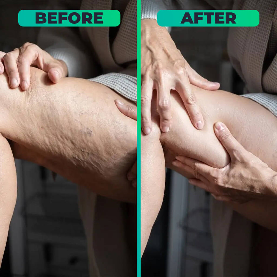 IonicCare Device – IonicStore