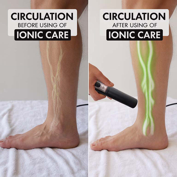 IonicCare Device – IonicStore